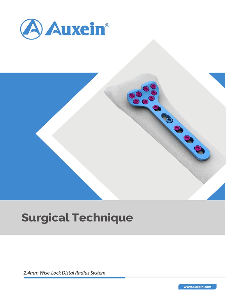 2.4mm Wise-Lock Distal Radius System | PDF | Screw | Hand
