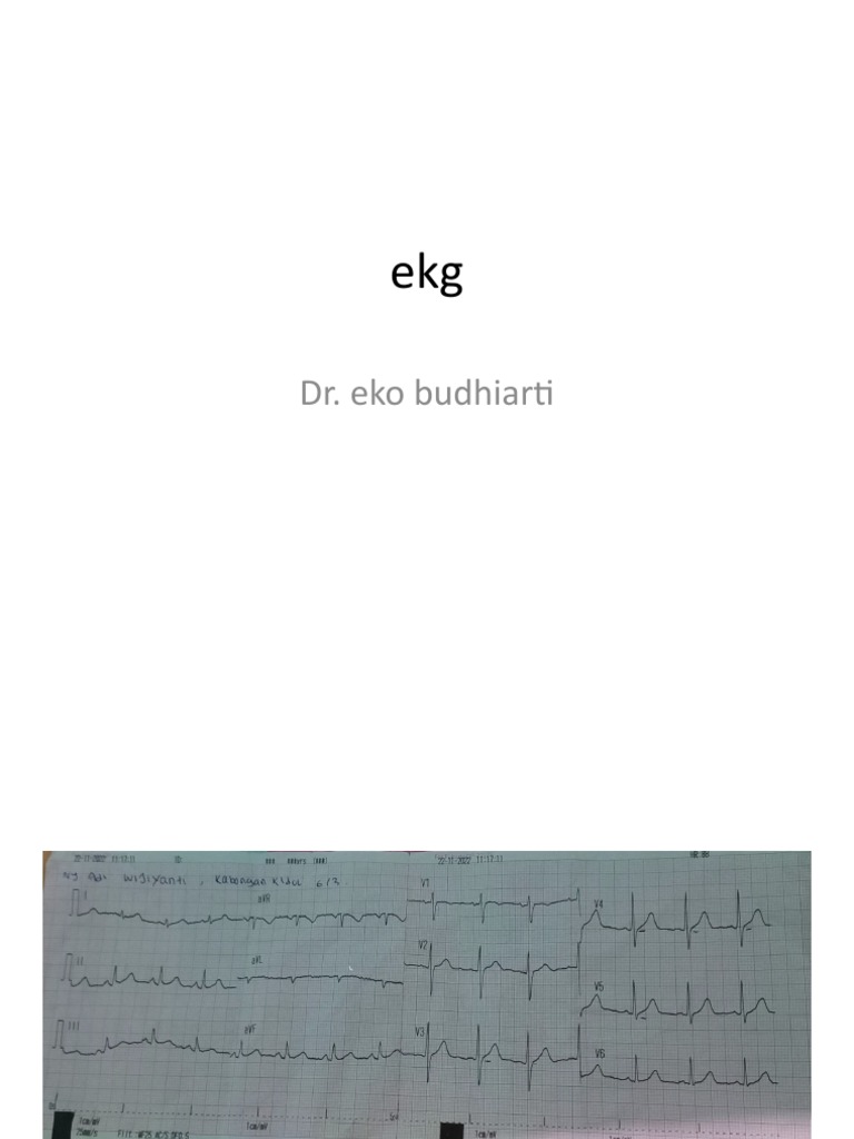 Hasil Ekg Ojt | PDF