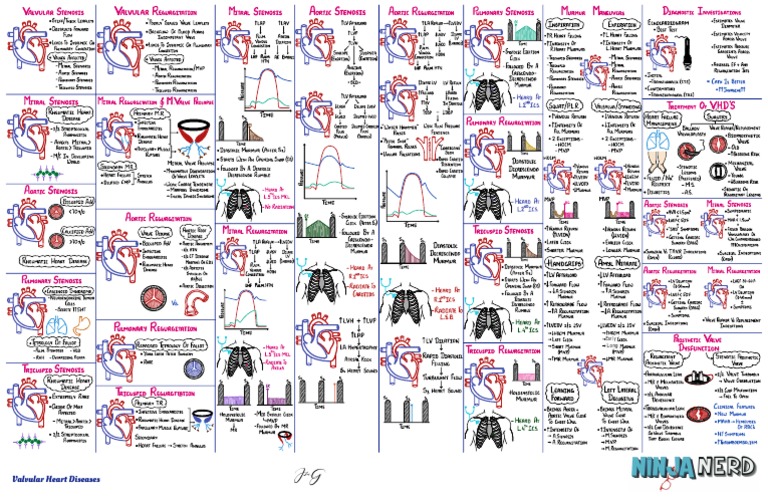 Cardiovascular Pathology - 025) Valvular Heart Diseases (Illustrations ...