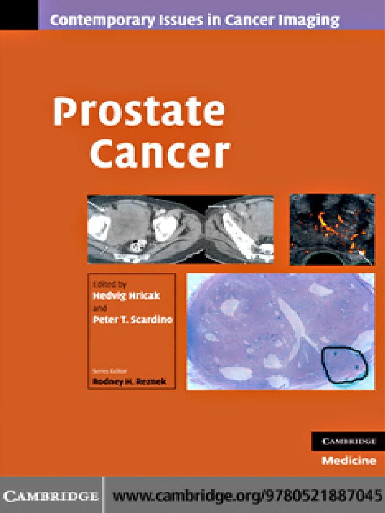 (Contemporary Issues in Cancer Imaging) Hricak - Prostate Cancer | PDF ...