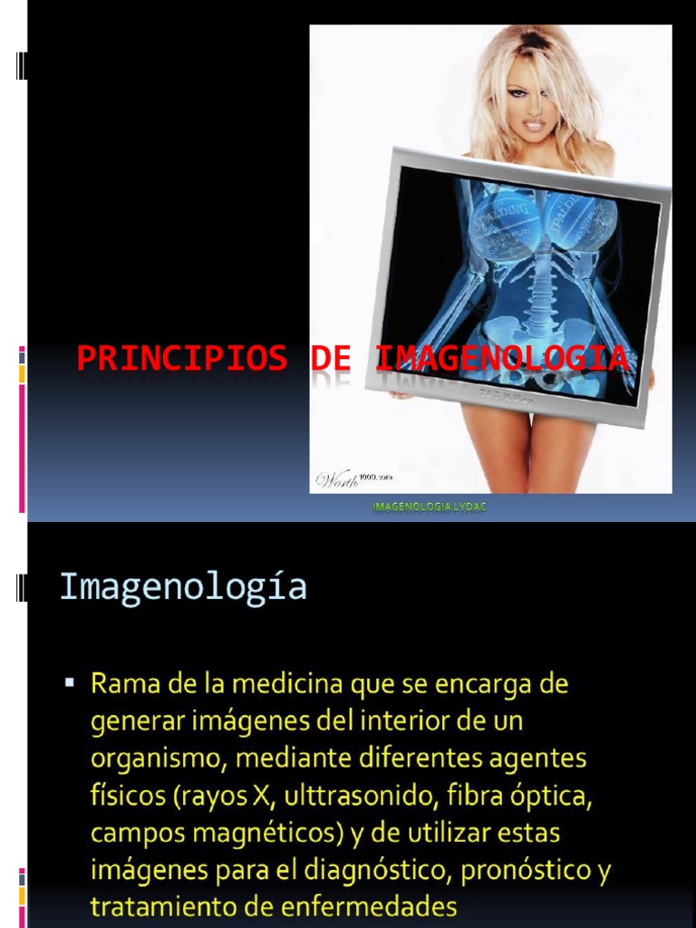 Principios de Imagenologia | PDF | Rayo X