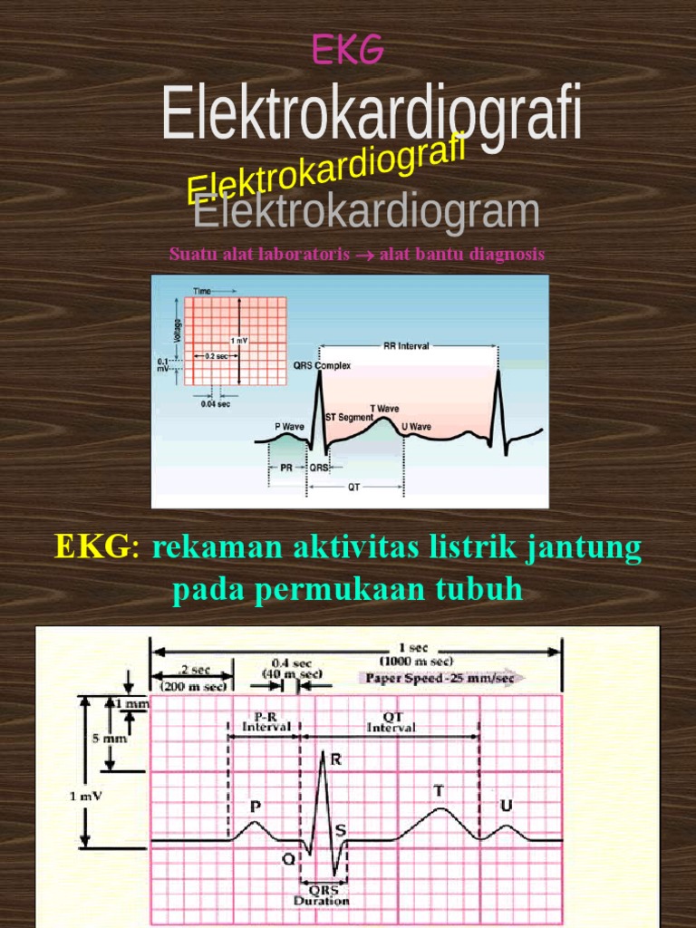EKG: Analisis dan Klasifikasi Takikardia | PDF | Physiology | Medical ...