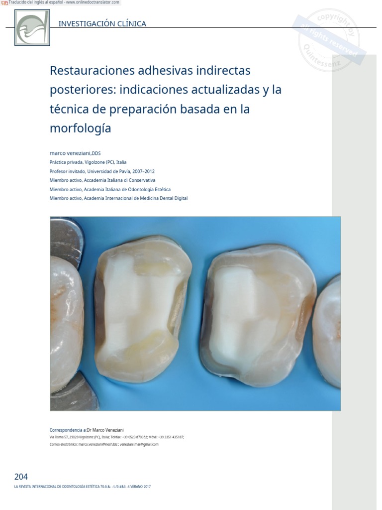 Posterior Indirect Adhesive Restorations. Updated Indications and The ...