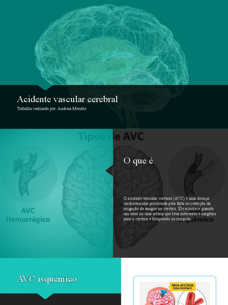 Acidente Vascular Cerebral | PDF | AVC | Medicina Clínica