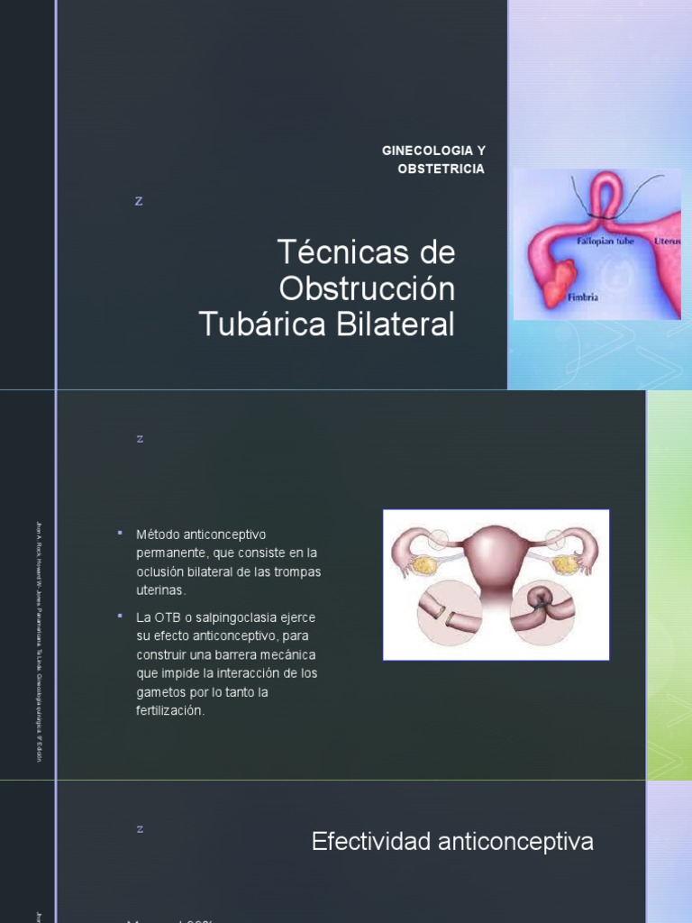 Técnicas de Obstrucción Tubárica Bilateral: Ginecologia Y Obstetricia ...