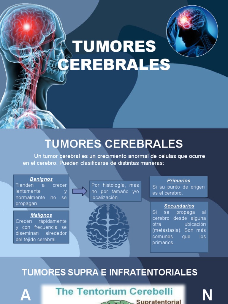 Tumores Cerebrales: Tipos y Tratamientos | PDF | Epilepsia | Cáncer