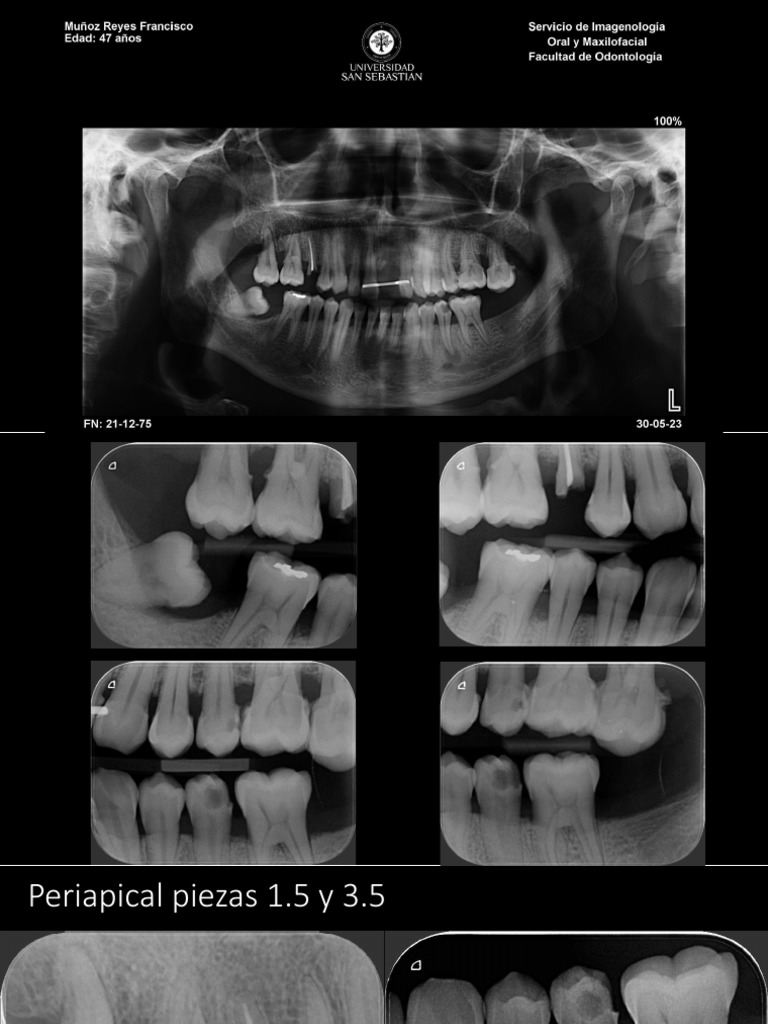 Radiografias | PDF