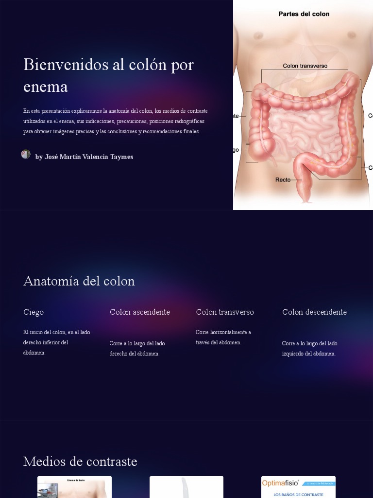 Bienvenidos Al Colon Por Enema | PDF | Cáncer colonrectal | Medicina ...