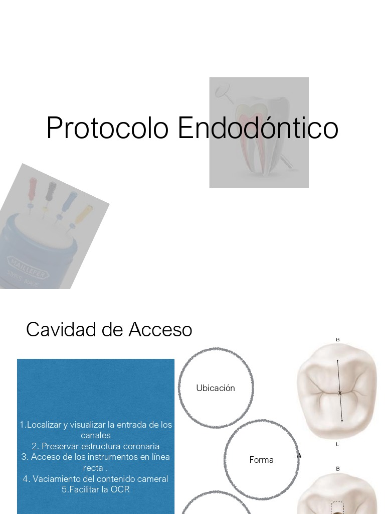 Capsula Protocolo Endodoncia PDF | PDF | Diente | Boca