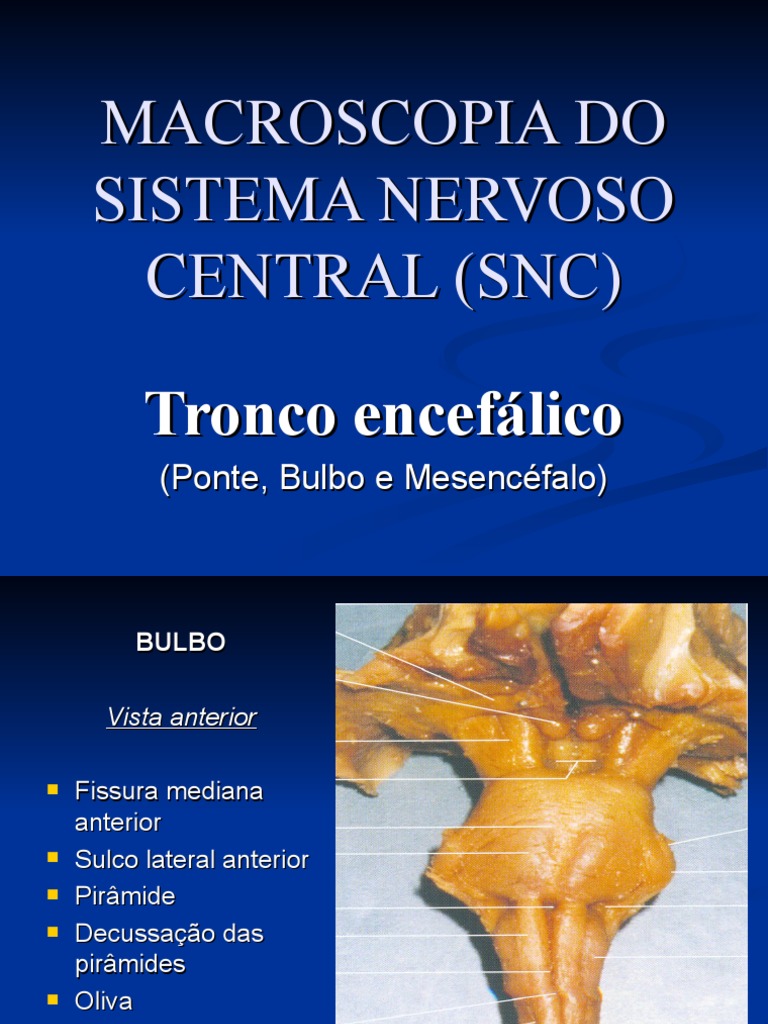 Neuro Cap.3.1 (Tronco Encefálico) | Download grátis PDF | Tronco ...