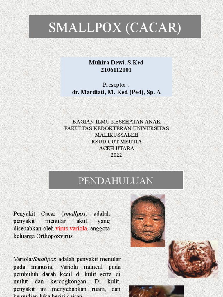 Smallpox (Cacar) | PDF