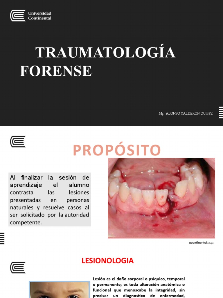 CLASE 13 - Traumatología OLF | PDF | Lesión | Derecho penal