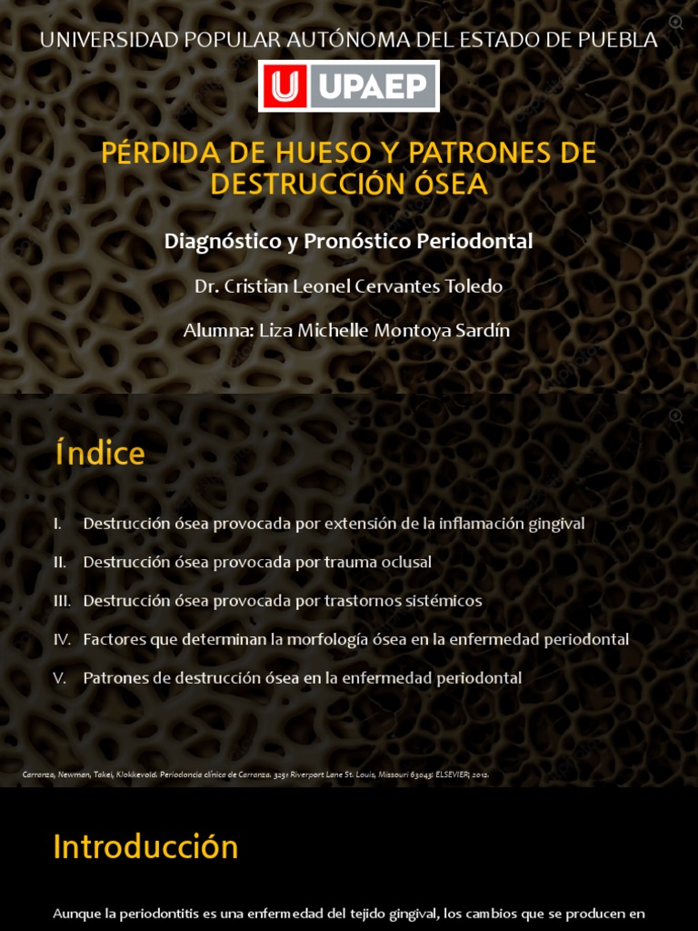 Clasificación de Defectos Óseos Periodontales | PDF | Hueso ...