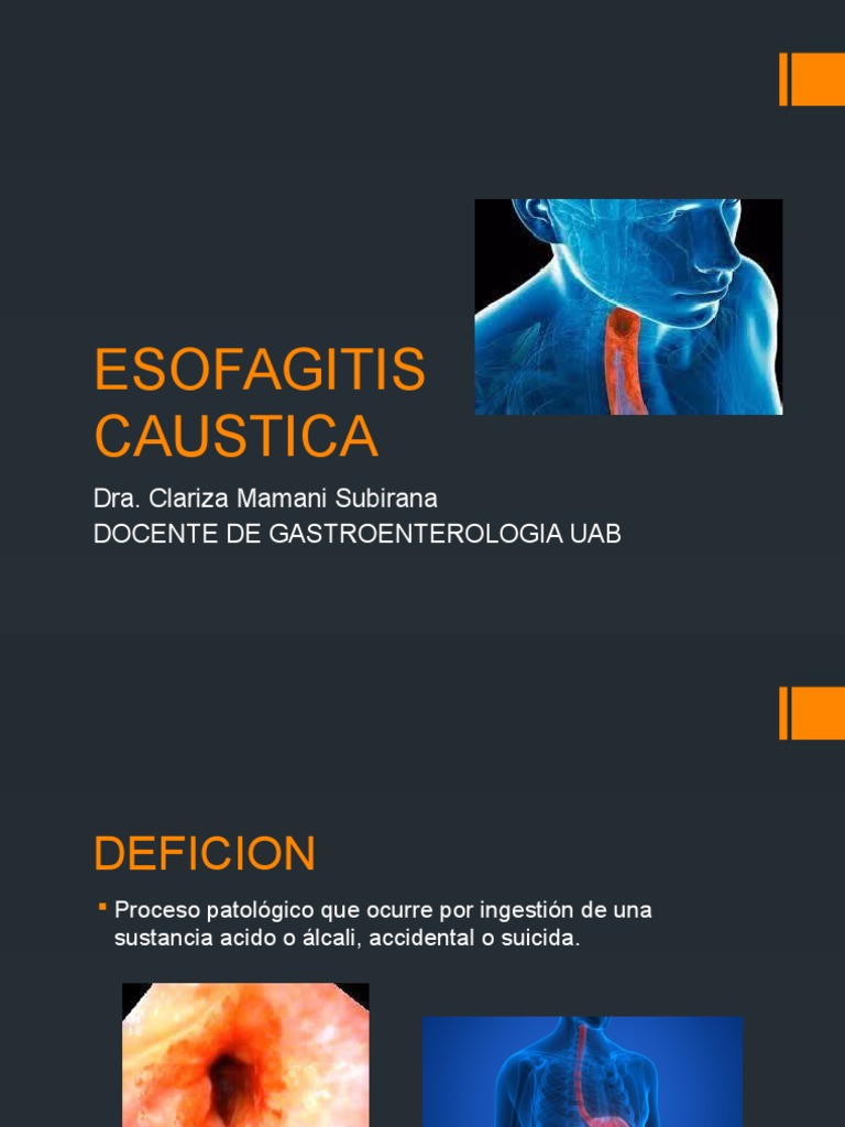 Esofagitis Cáustica: Causas y Tratamiento | PDF | Medicina | Causas de ...