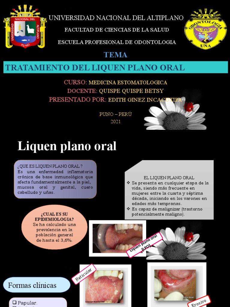 Liquen Plano Oral Ppts | PDF | Medicina CLINICA | Epidemiología