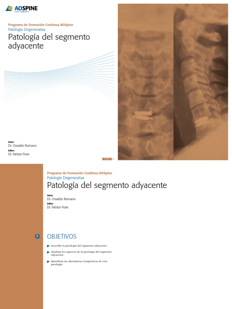 10-Patología Del Segmento Adyacente | PDF | La columna vertebral ...