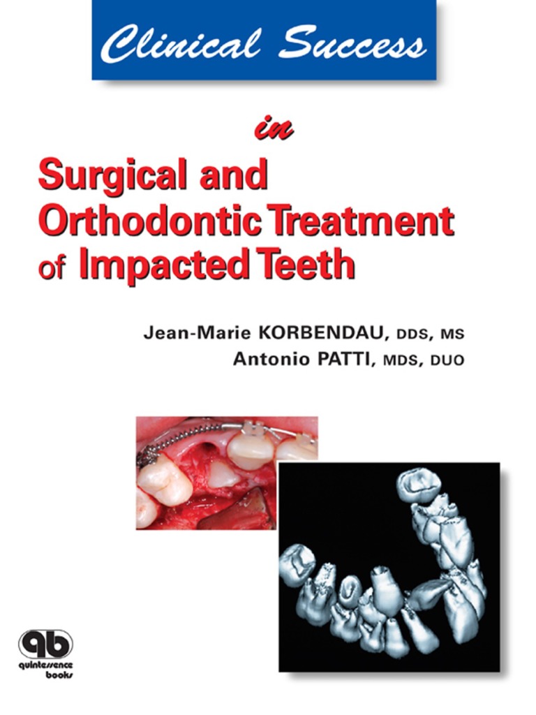 Clinical Success in Surgical and Orthodontic Treatment of Impacted Teeth - Jean-Marie KORBENDAU ...