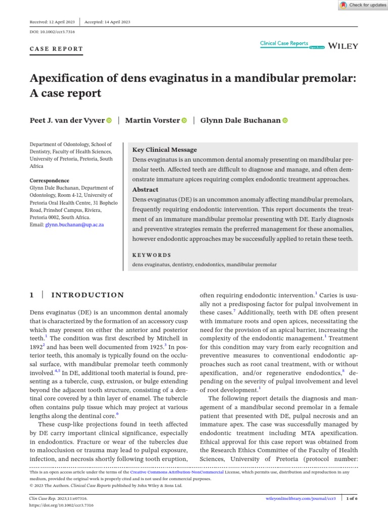Apexification in Dens Evaginatus Case | PDF | Dental Anatomy | Mouth