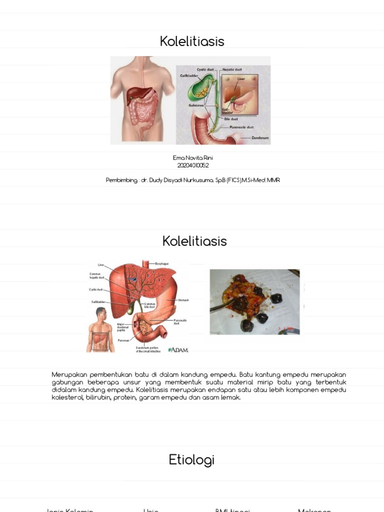 KOLELITIASIS | PDF