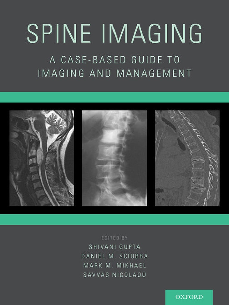 Spine Imaging A Case Based Guide To Imaging | PDF | Vertebral Column ...