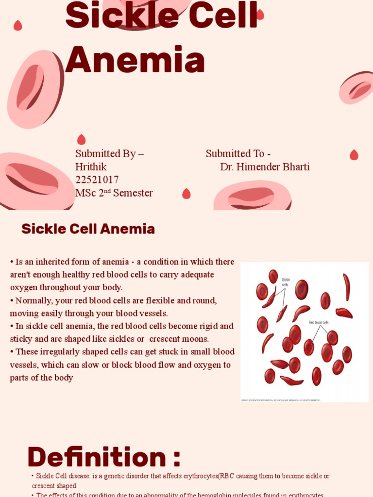 Sickle Cell Anemia | Download Free PDF | Hematopoietic Stem Cell ...