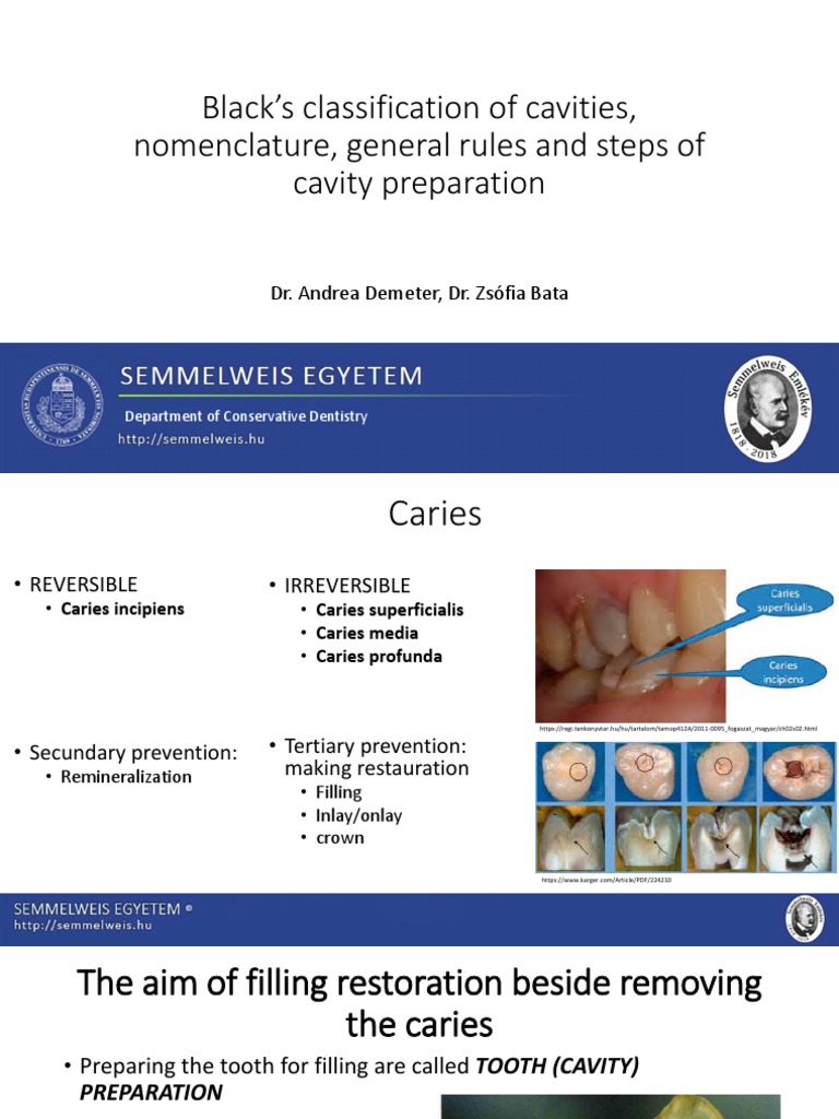 Black's Cavity Classification Overview | PDF | Dentistry Branches ...