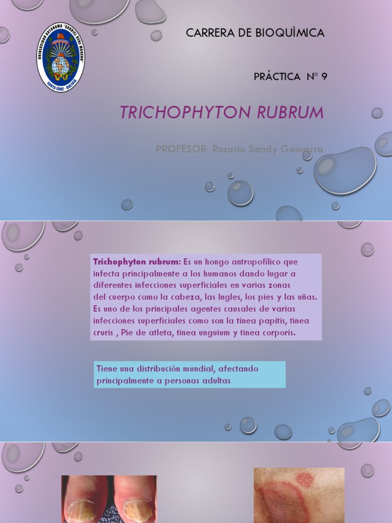 Trichophyton rubrum (1) | PDF | Causas de la muerte | Especialidades ...