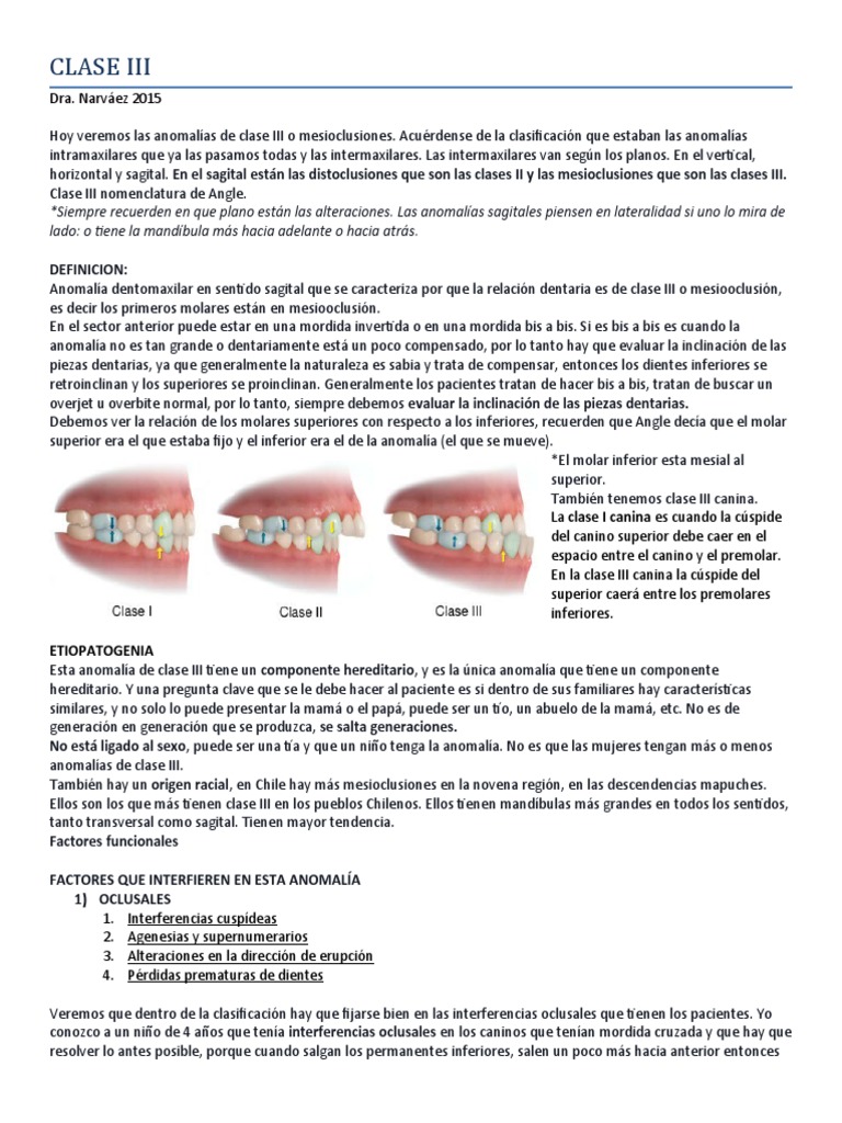 Anomalías de Clase III: Mesioclusiones Dentales | PDF | Ortodoncia | Diente