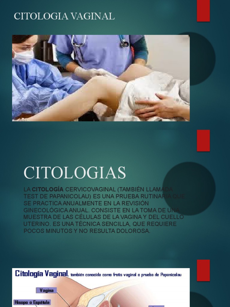 Citologia Vaginal | PDF