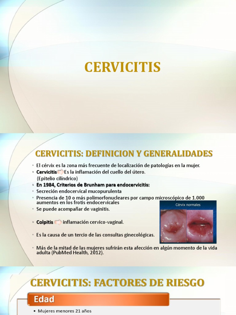 Cervicitis 2022 Version 1 | PDF | Especialidades Medicas | Causas de la ...