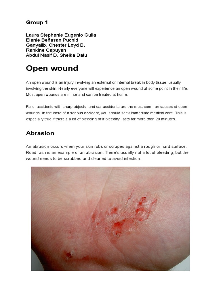 Open Wound | PDF | Wound | Health Sciences