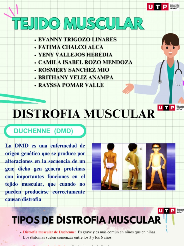 Distrofia Muscular | PDF | Medicina CLINICA | Especialidades Medicas