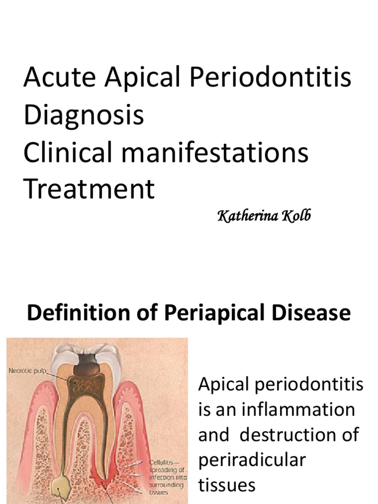 Acute Apical Periodontitis Apical Periodontitis