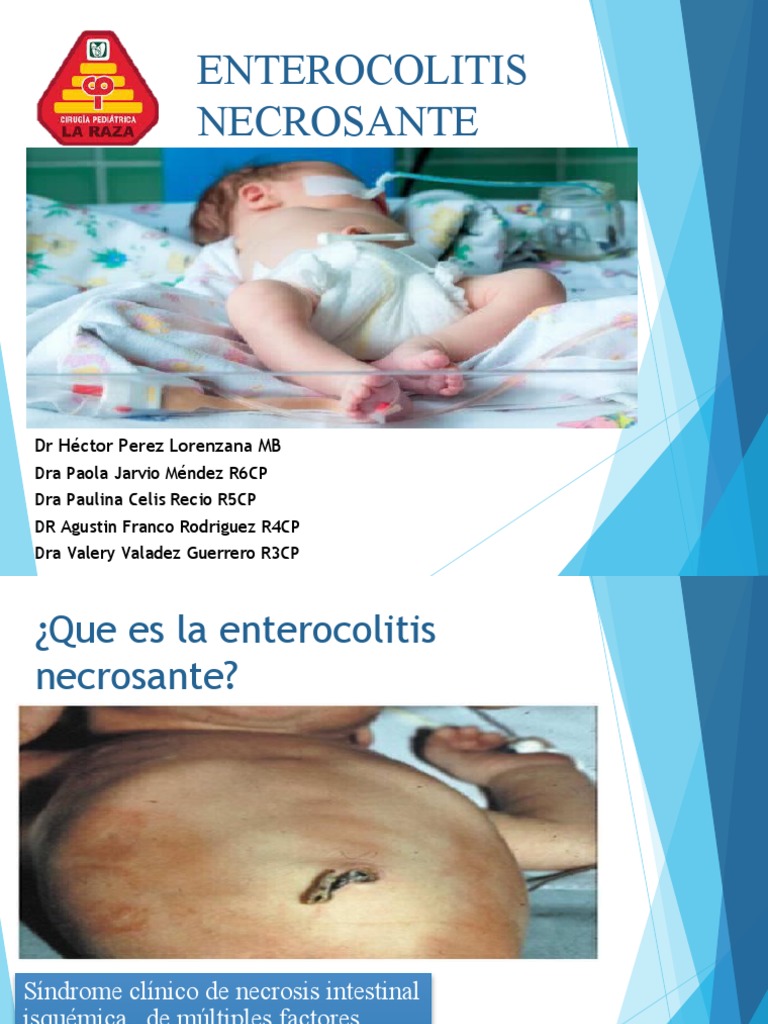 13 CLASE ENTEROCOLITIS NECROSANTE 2021 El Bueno Final | PDF | Diarrea ...