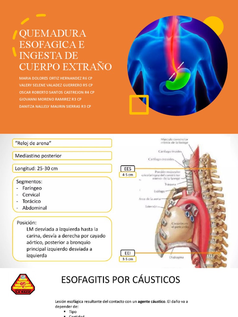 quemadura esofagica 1 PARTE | PDF | Estómago | Especialidades Medicas