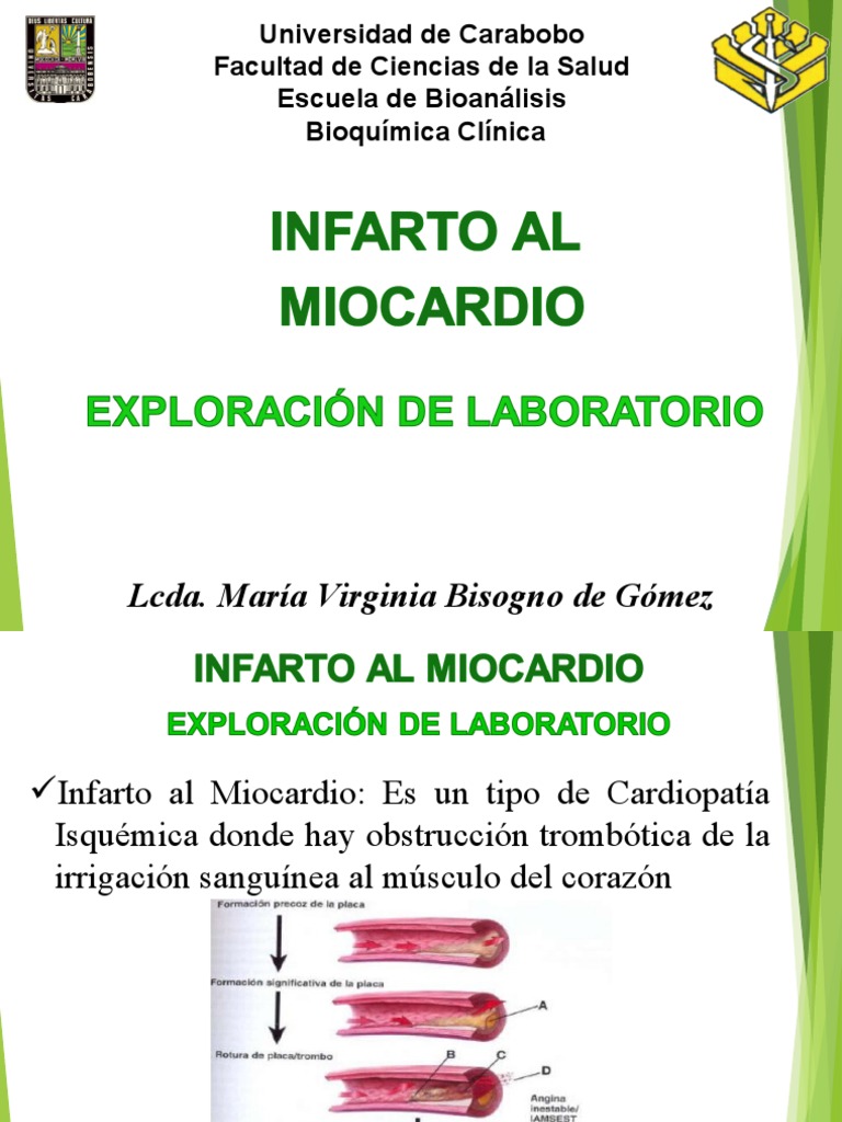 Infarto Al Miocardio | PDF | Infarto de miocardio | Medicina CLINICA