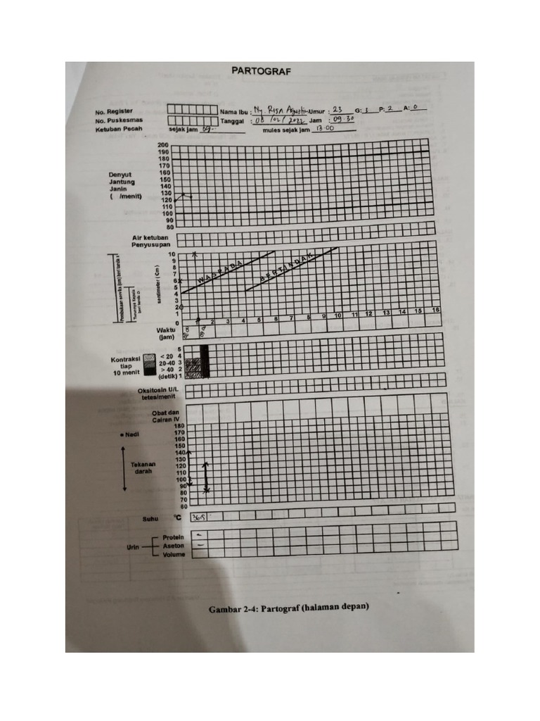 PARTOGRAF 2022 | PDF