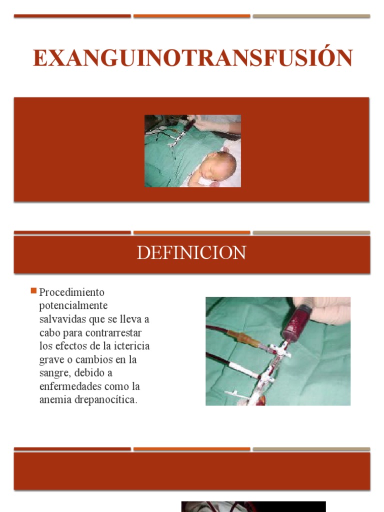 Exanguinotransfusión | PDF | Sangre | Medicina