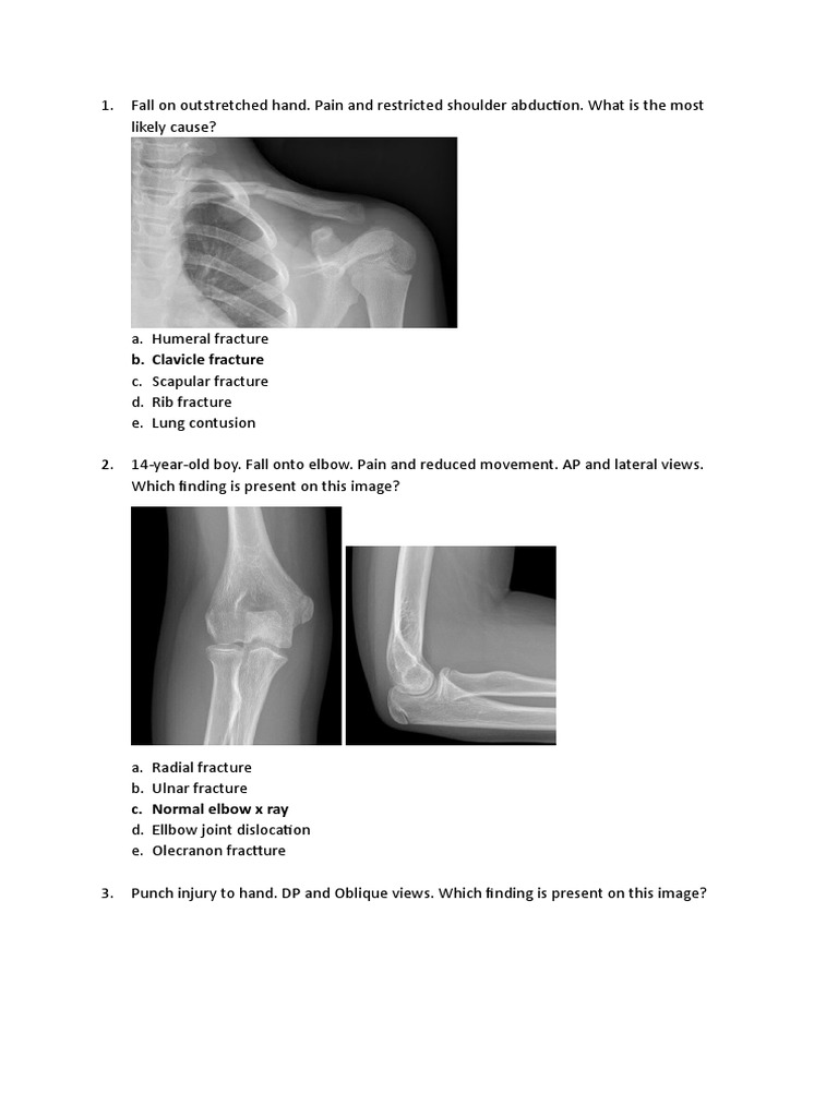 Soal muskulo mcq | PDF