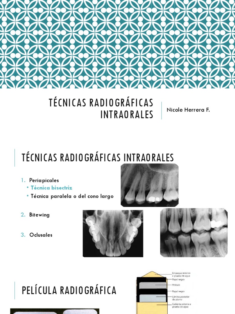 Técnicas Radiográficas Intraorales | PDF | Diente | Boca