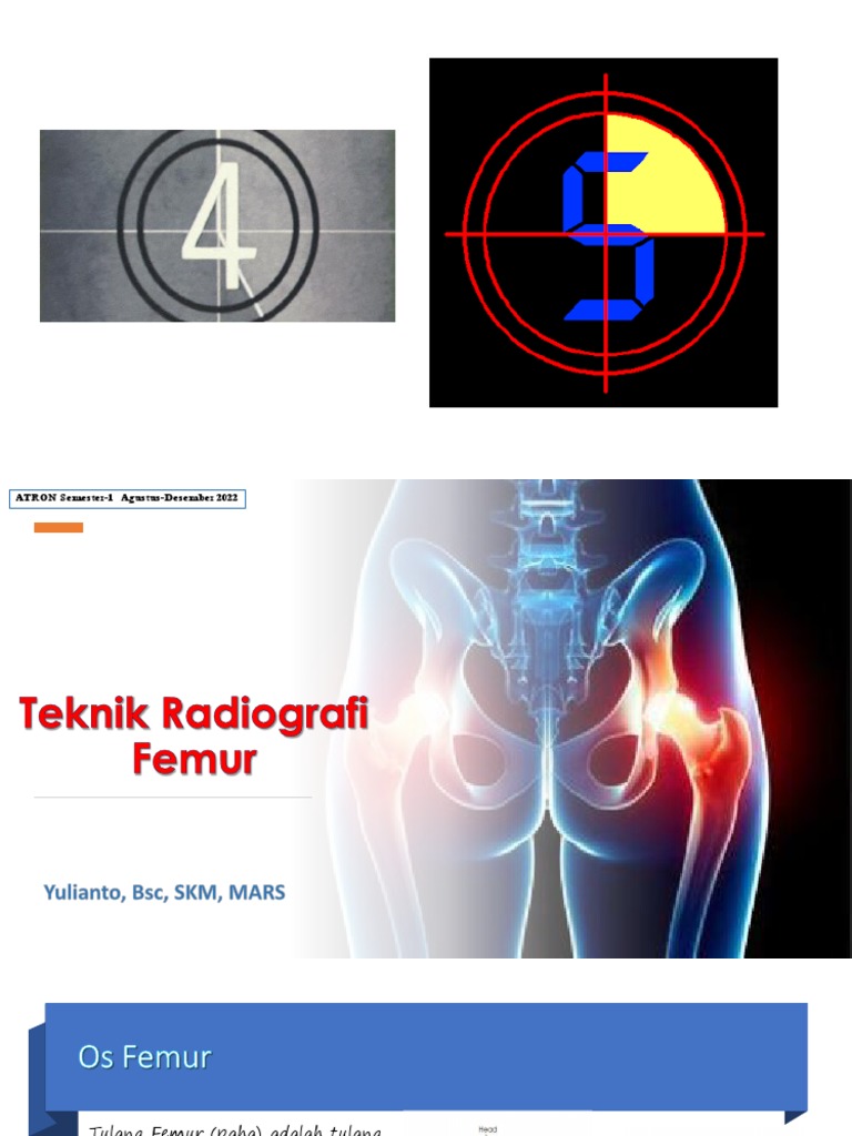 TRD-1 Teknik Radiografi Os Femur AP&Lateral | PDF