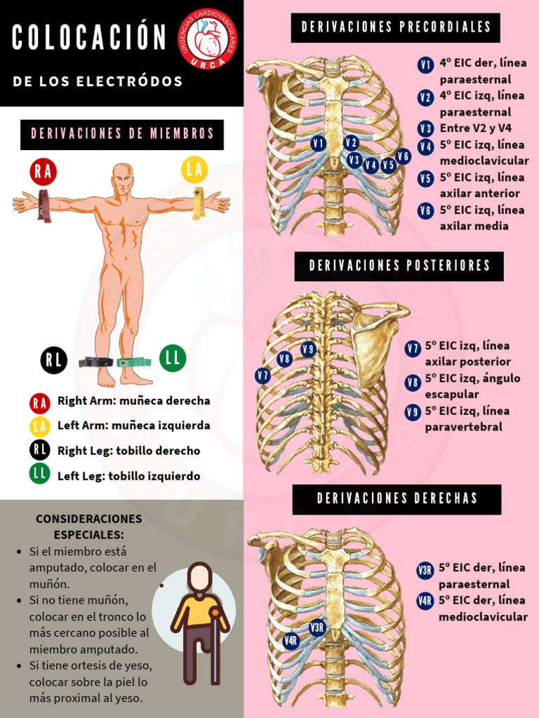 Infografias Colocacion-De-Los-Electrodos | PDF