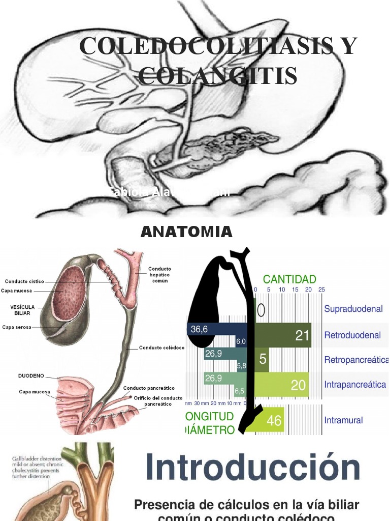COLEDOCOLITIASIS | PDF