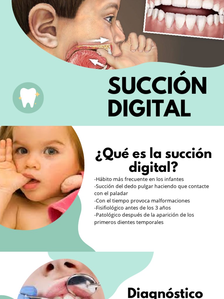 Succión digital | PDF