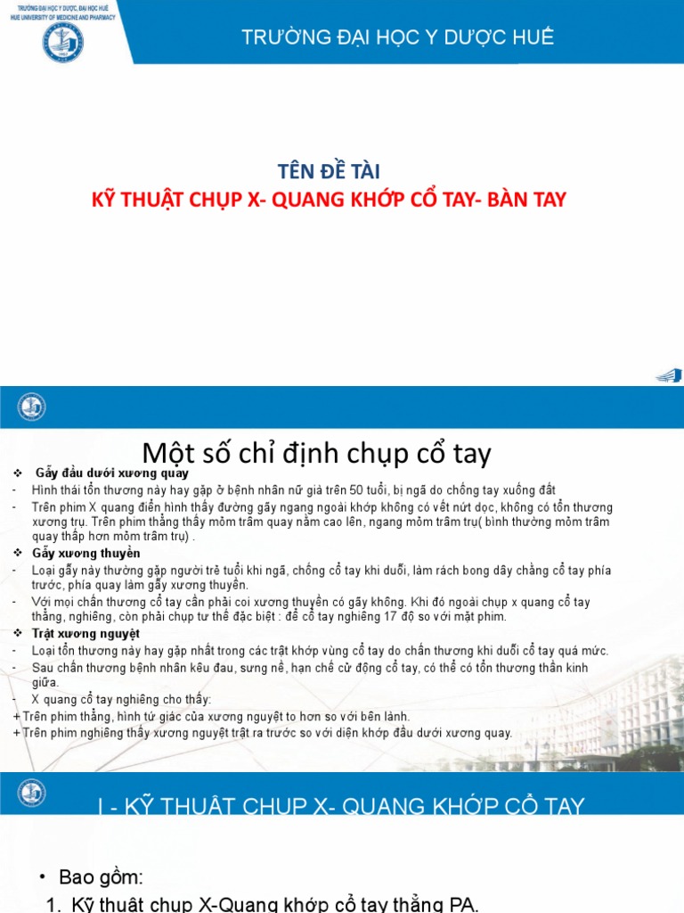 Nhóm 3 X-Quang C Tay - Bàn Tay. | PDF