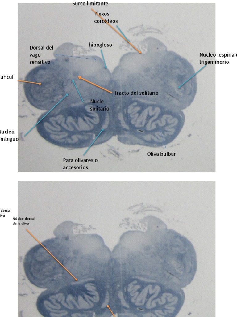 Histo Tronco Encefalico | PDF