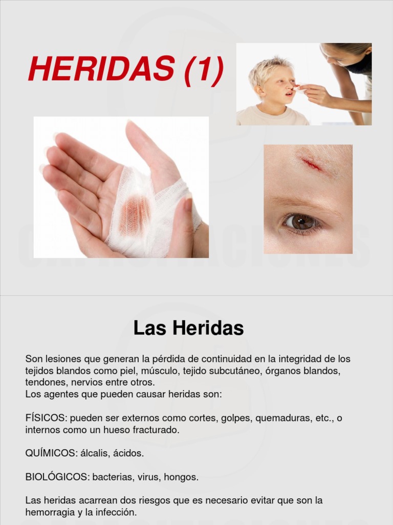 Heridas, Hemorragias, Quemaduras y Vendajes | PDF | Herida | Primeros auxilios