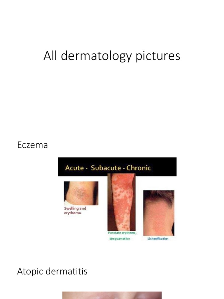 Dermatology Images and Skin Conditions | PDF | Dermatitis | Psoriasis