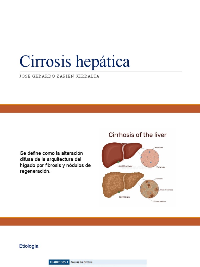 Cirrosis hepática | PDF