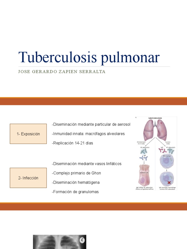 Tuberculosis Pulmonar | PDF | Tuberculosis | Especialidades Medicas